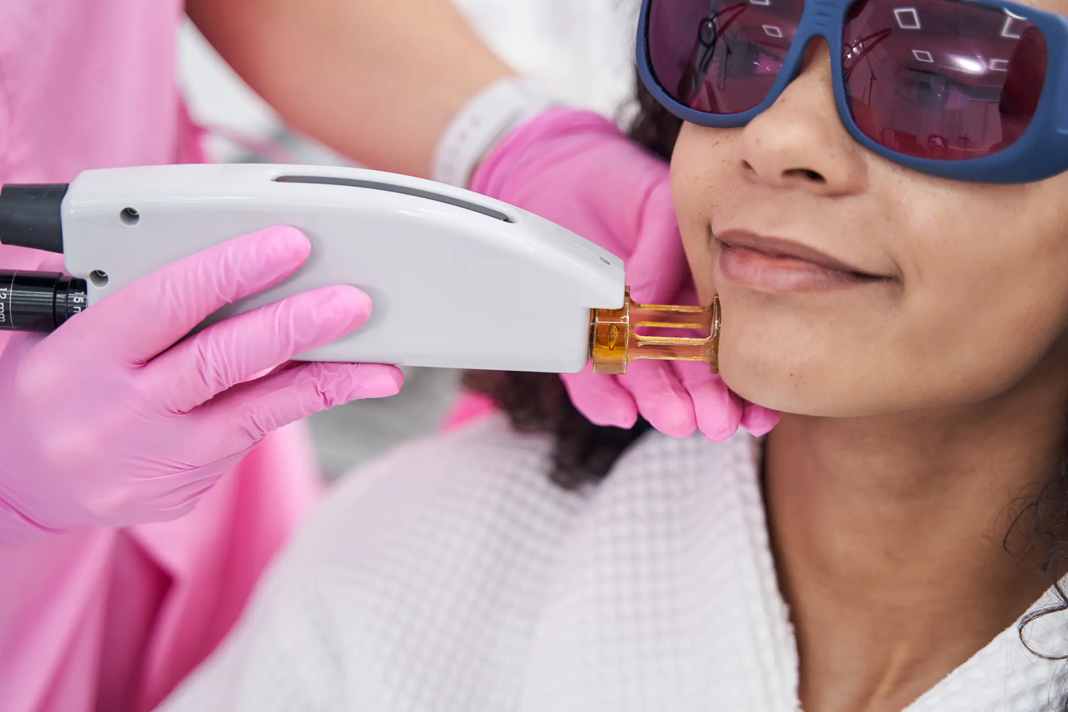 Learn About Laser Hair Removal - Sweet Heart Brazilian Wax